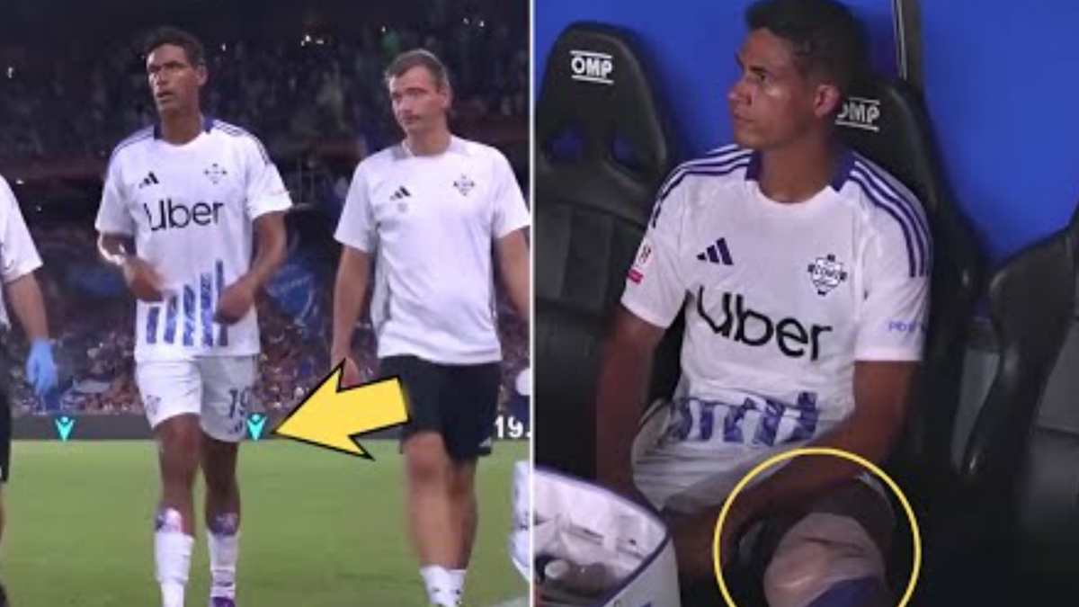 Como Varane infortunato, quali e e quante partite salta